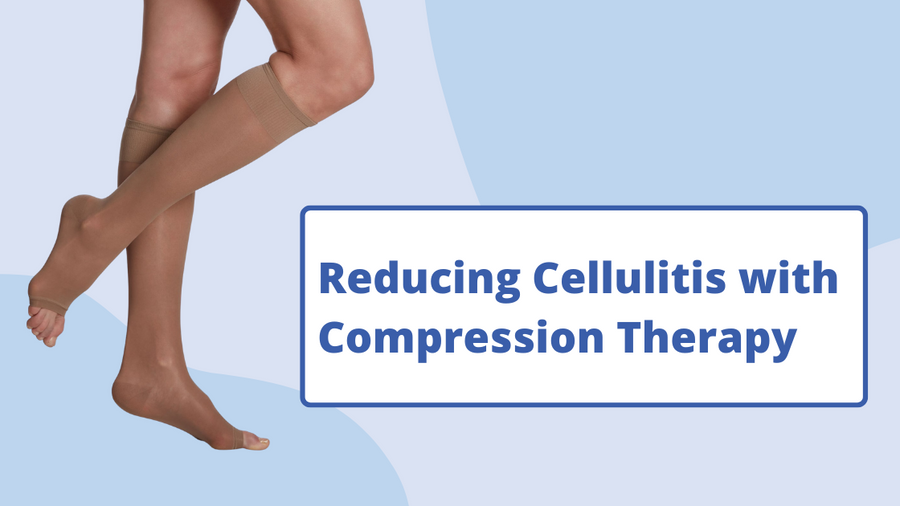 Reducing Cellulitis with Compression Therapy · Nightingale Medical Supplies